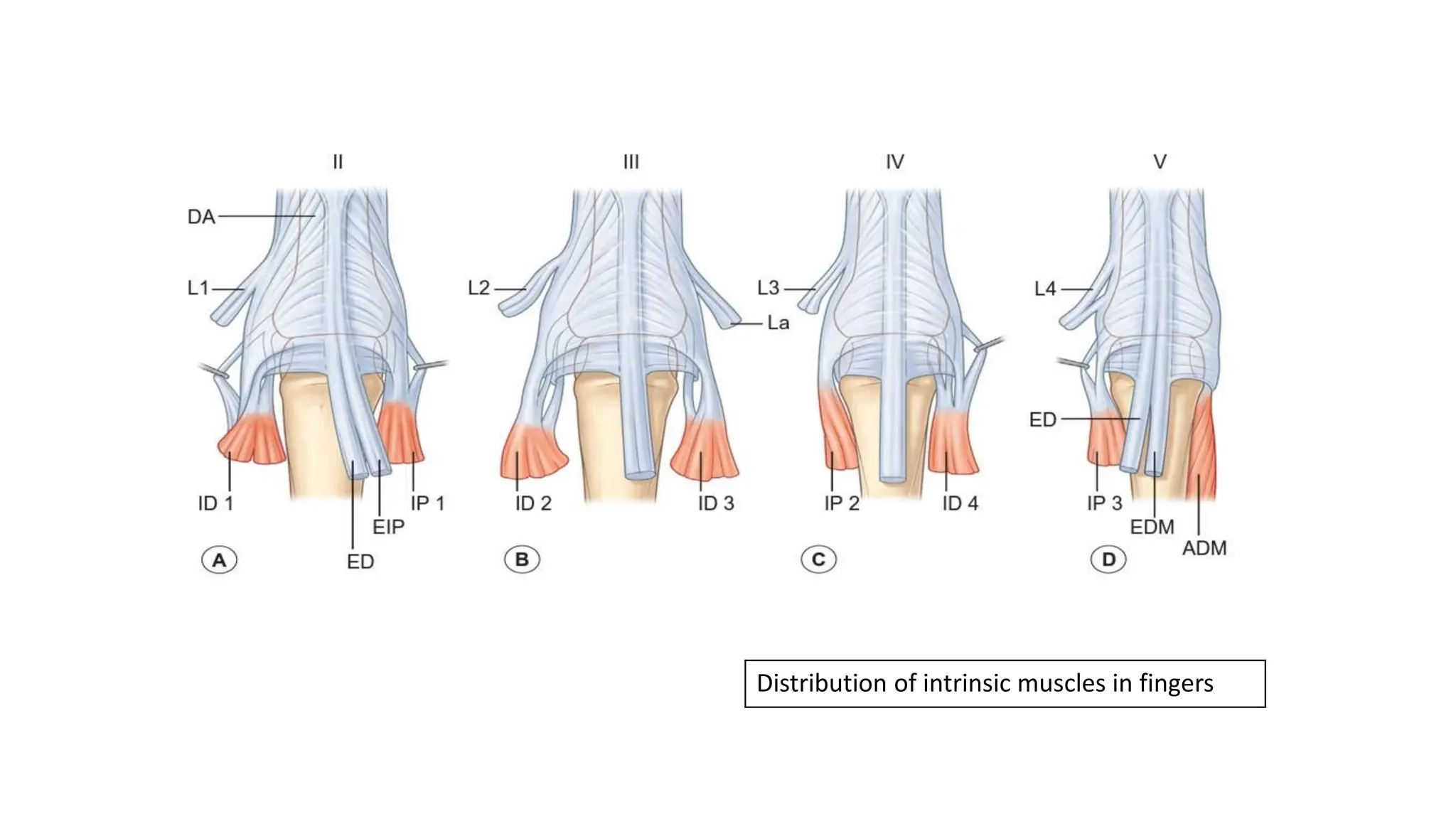 Acute Extensor tendon injuries diagnosis and management.pptx