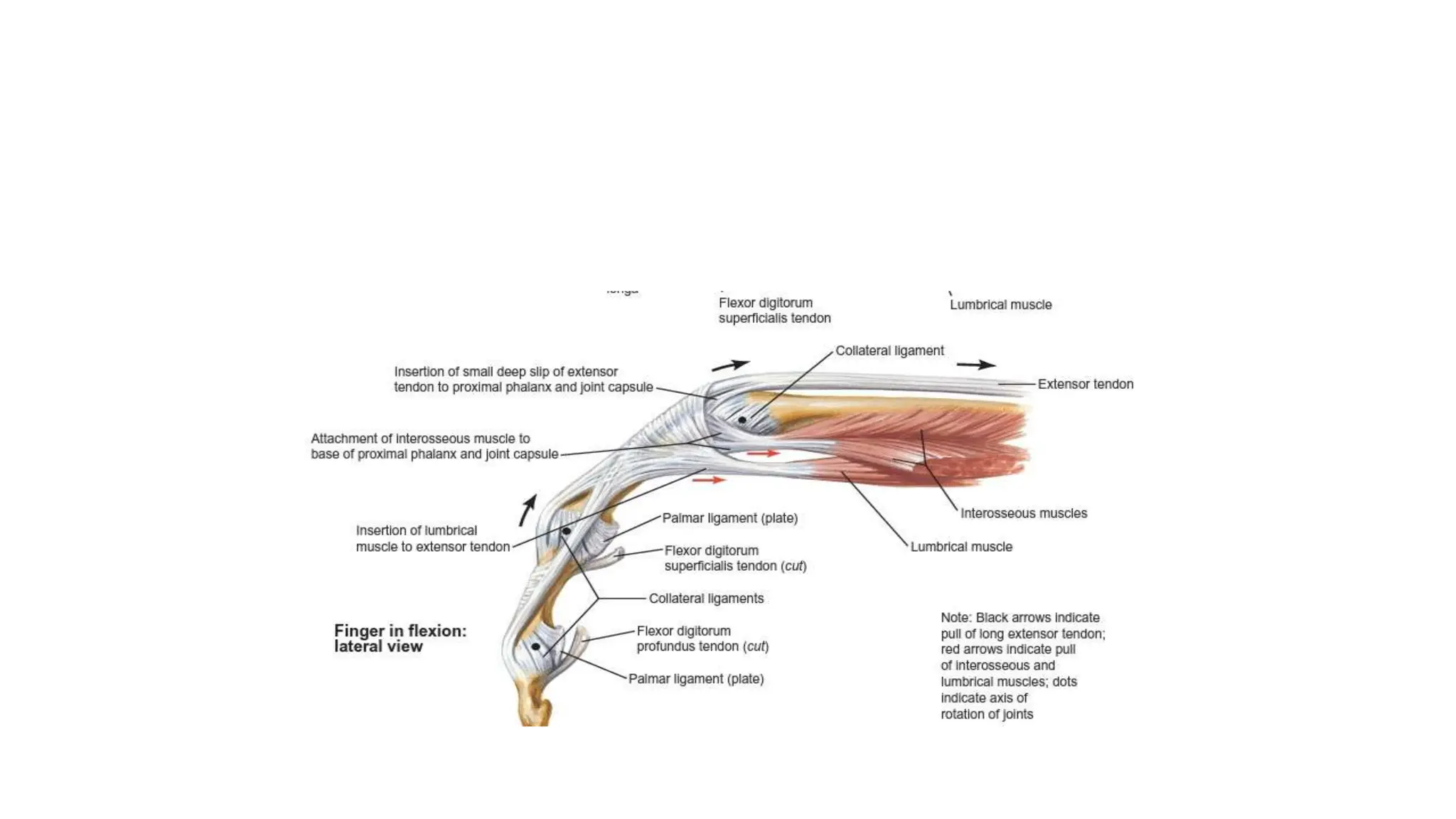 Acute Extensor tendon injuries diagnosis and management.pptx