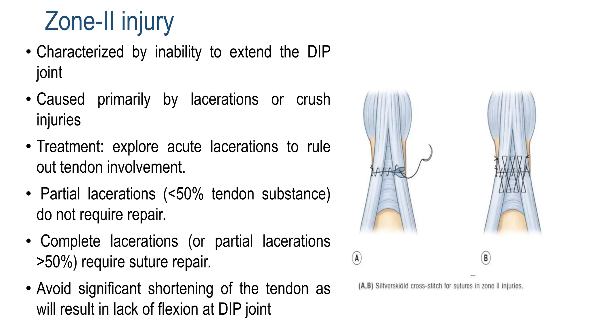Acute Extensor tendon injuries diagnosis and management.pptx