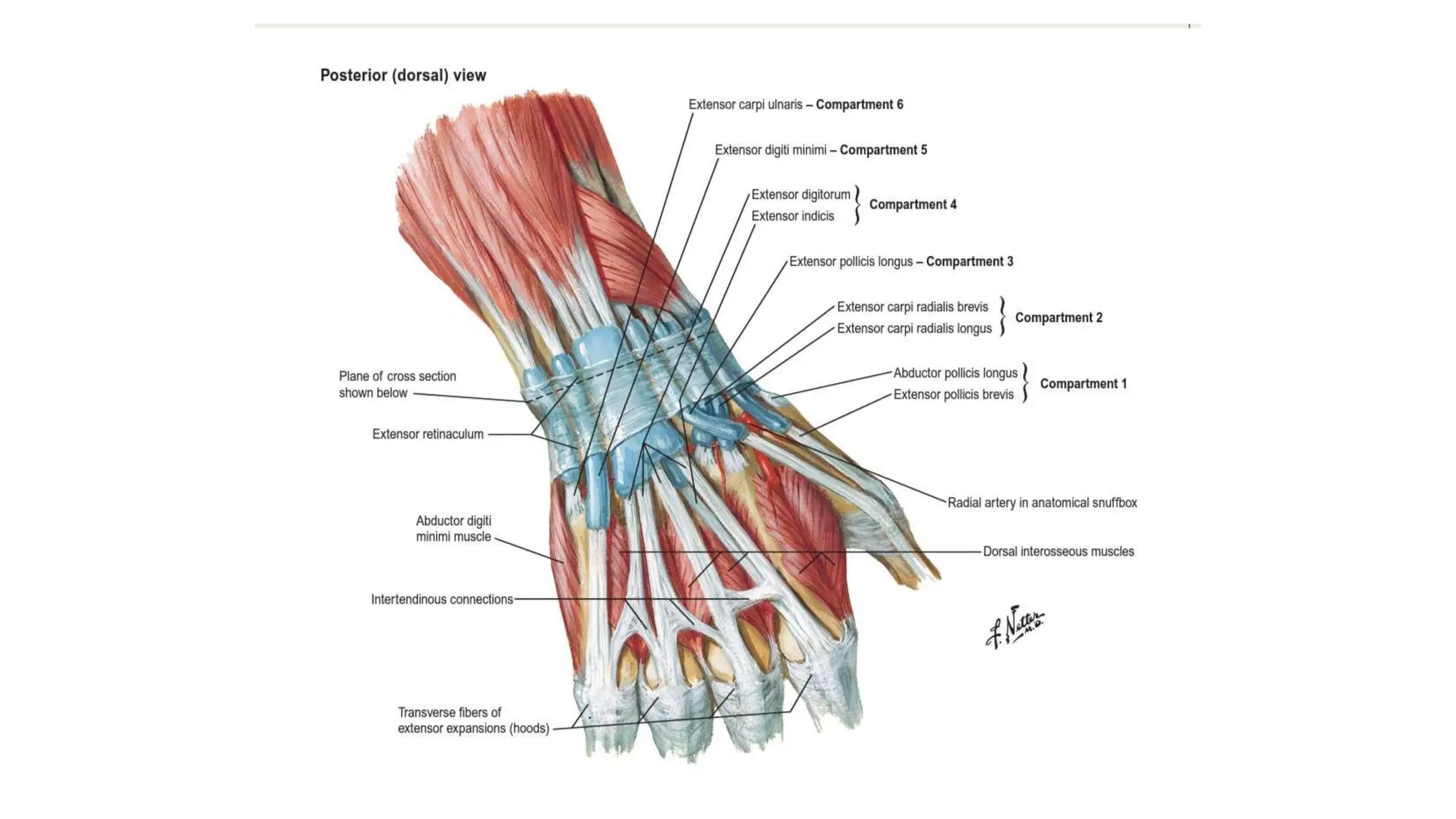 Acute Extensor tendon injuries diagnosis and management.pptx | Death ...