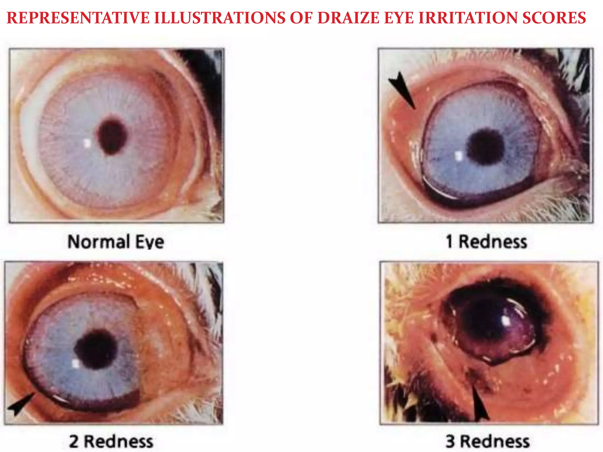 Acute eye irritation/corrosion- 405 | PPTX