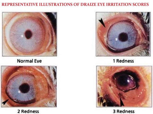 Acute eye irritation/corrosion- 405 | PPTX