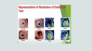 acute eye irritation studies as per OECD guidelines | PPTX