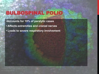 Acute flaccid paralysis | PPT