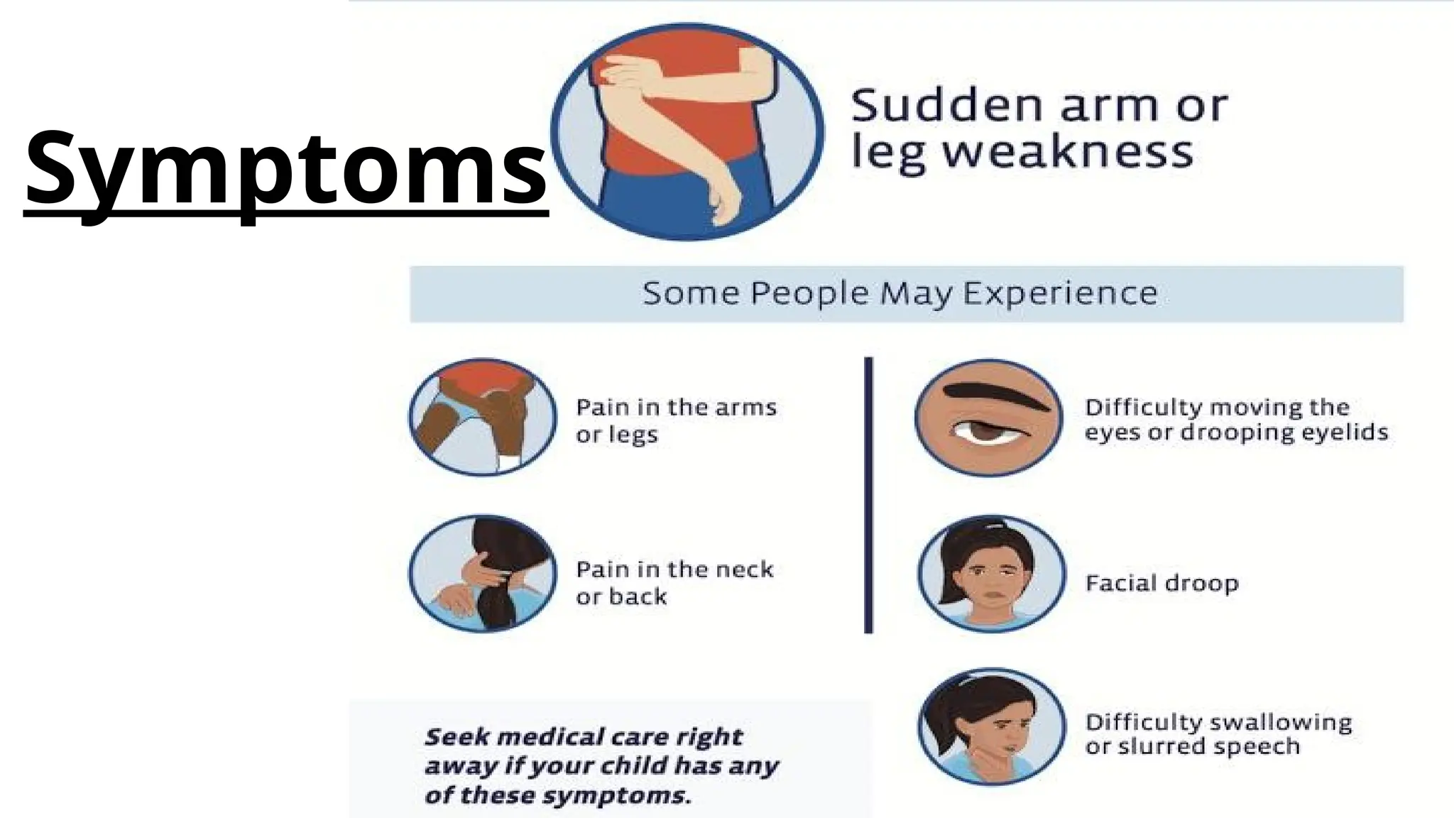 Acute flaccid paralysis. Causes, investigation, management | PPTX