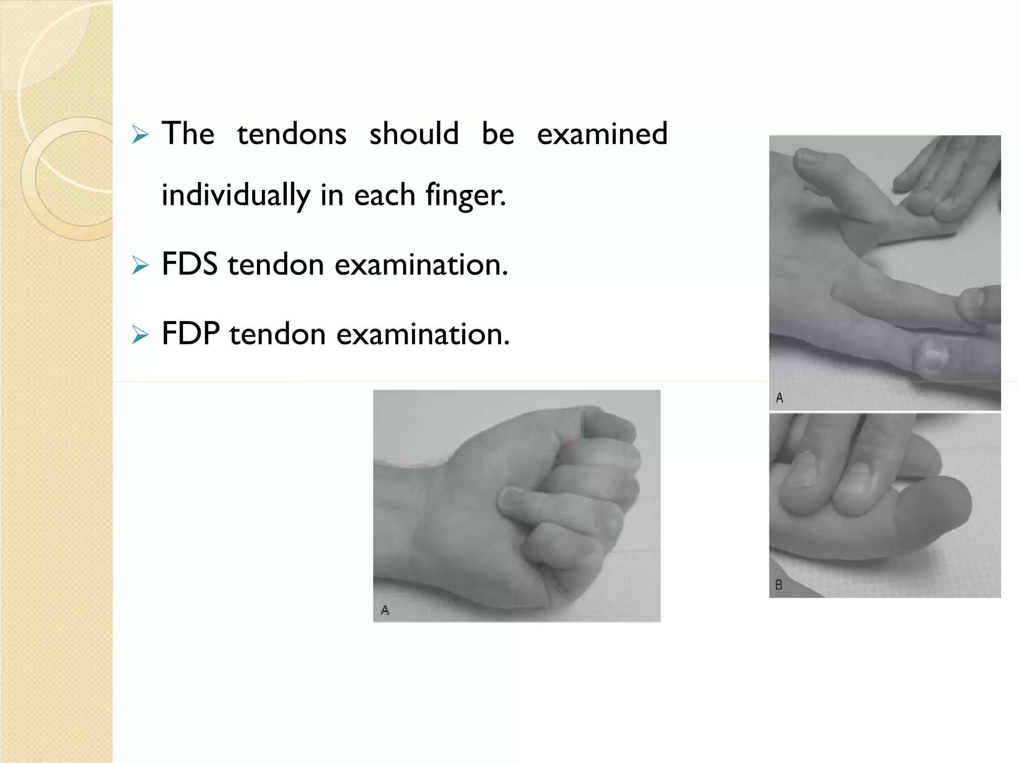 Acute flexor tendon injuries z 1 | PDF