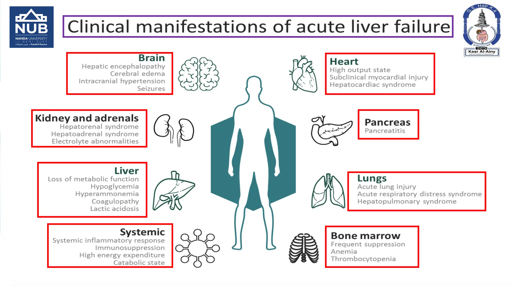 Acute (Fulminant) Liver Failure For Undergraduate.pdf