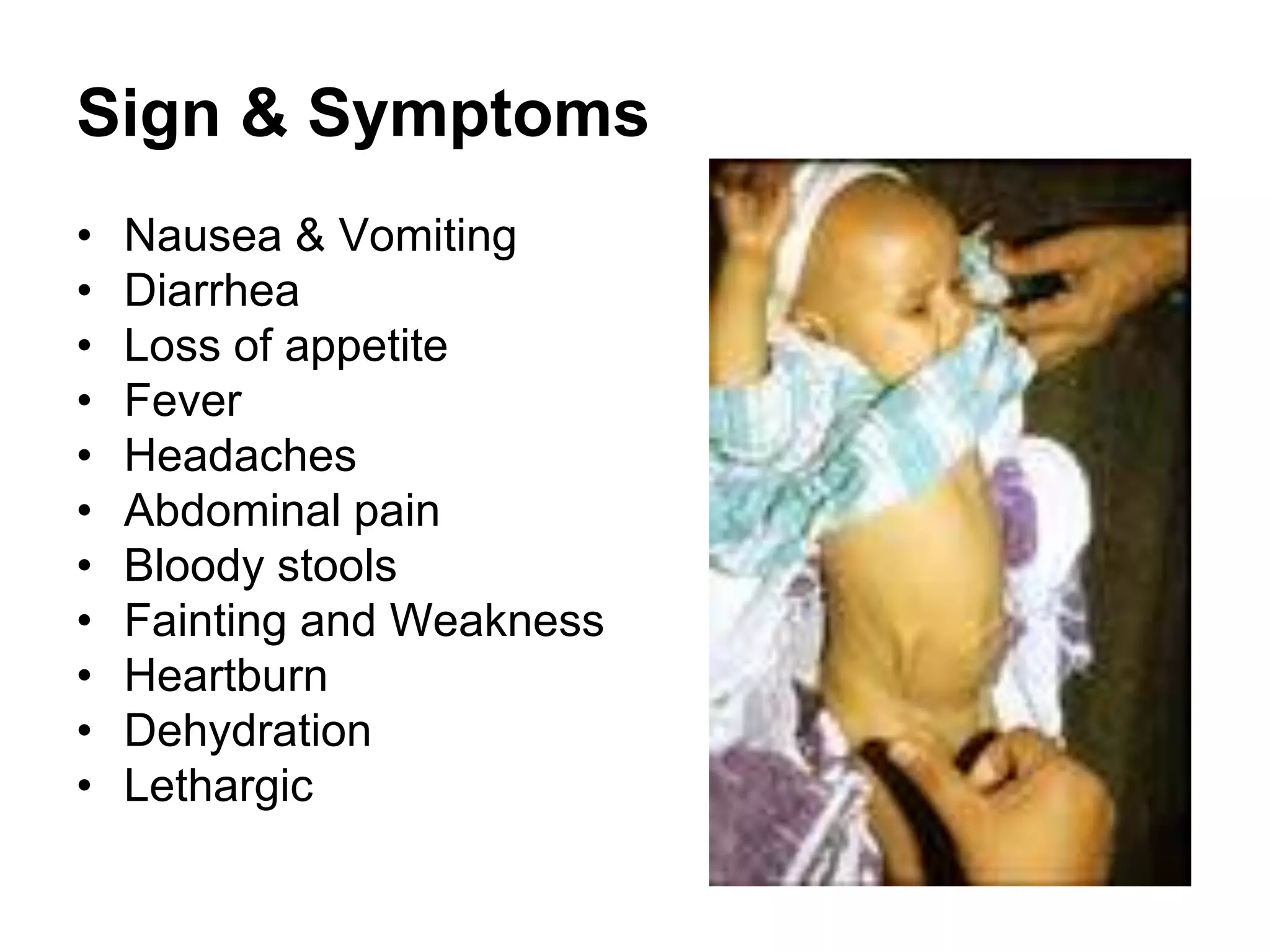 ACUTE PEDIATRIC GASTROENTERITIS | PPTX
