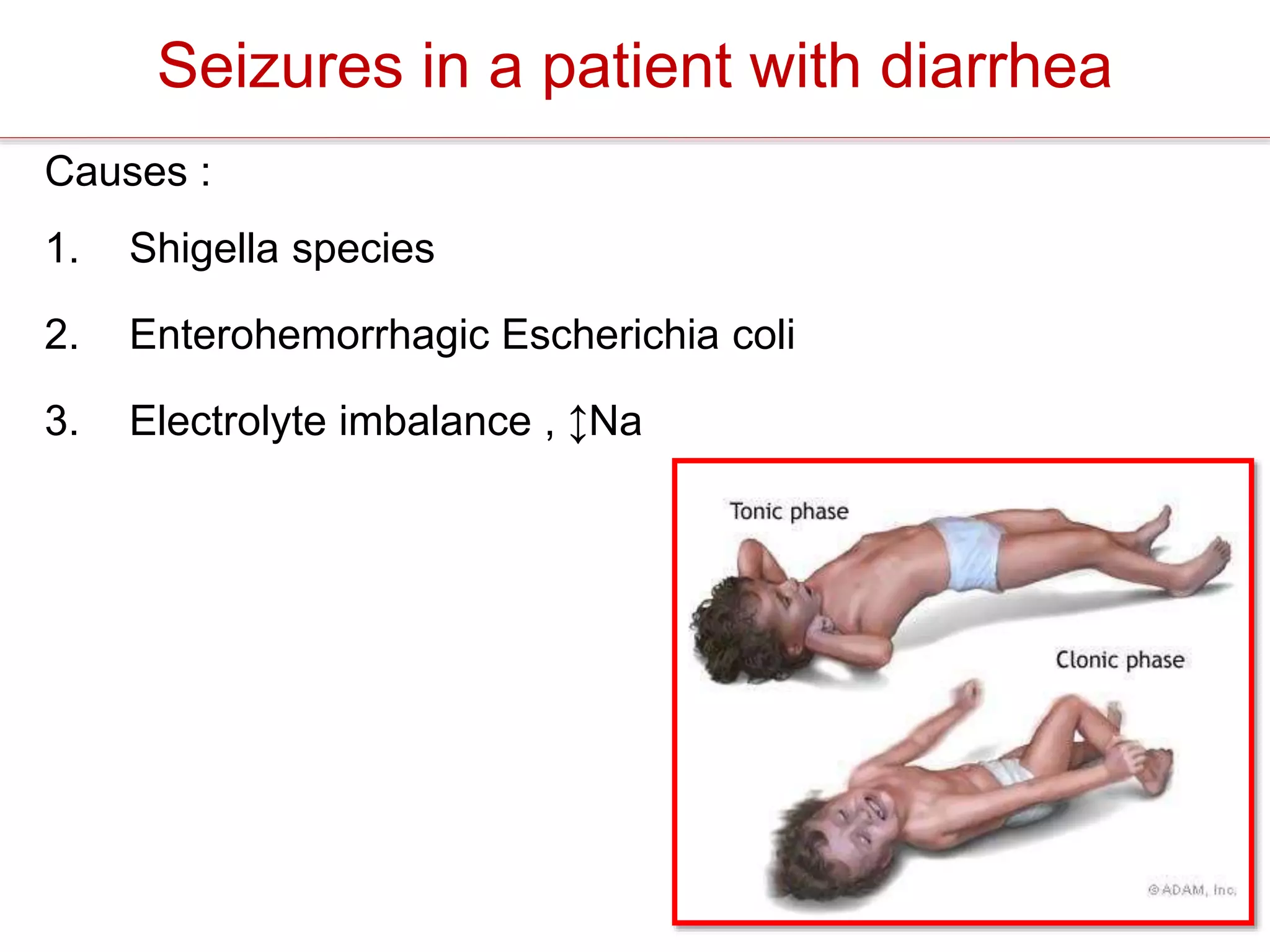 ACUTE PEDIATRIC GASTROENTERITIS | PPTX