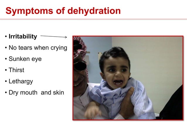 ACUTE PEDIATRIC GASTROENTERITIS | PPTX | Digestive Disorders | Diseases ...