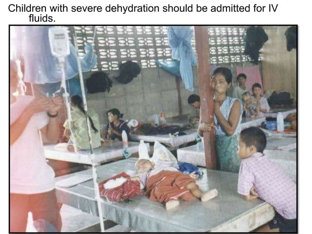 ACUTE PEDIATRIC GASTROENTERITIS | PPTX | Digestive Disorders | Diseases ...