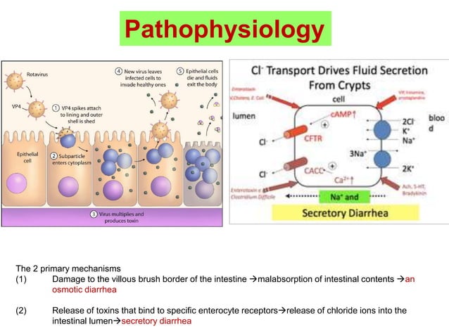 ACUTE PEDIATRIC GASTROENTERITIS | PPTX | Digestive Disorders | Diseases ...