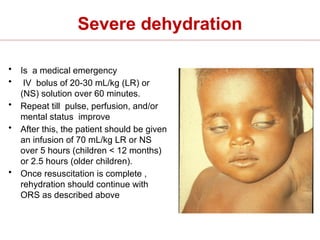 Acute Gastroenteritis Management in Paediatric Patients | PPTX