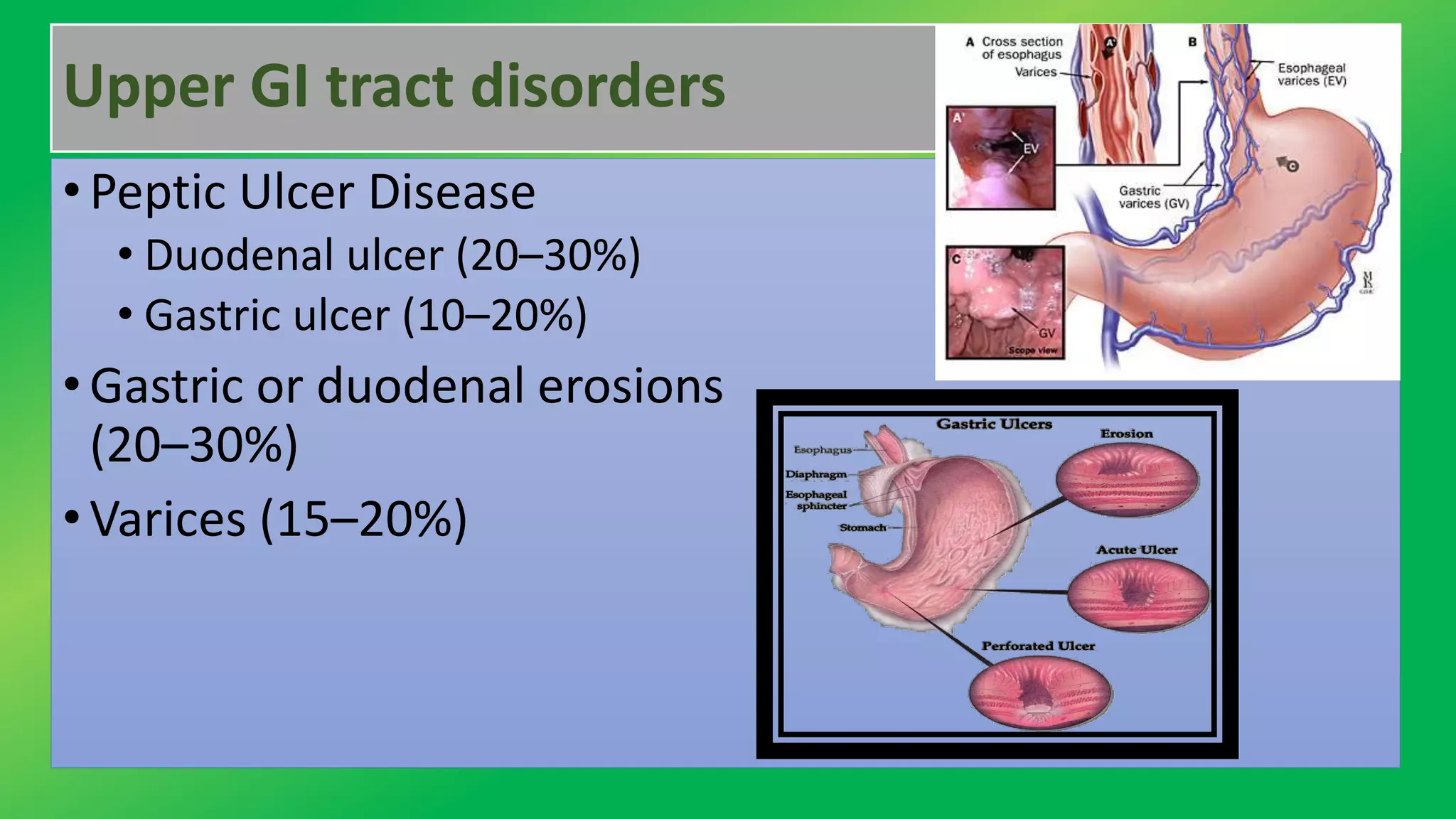 Acute GI bleed | PPTX