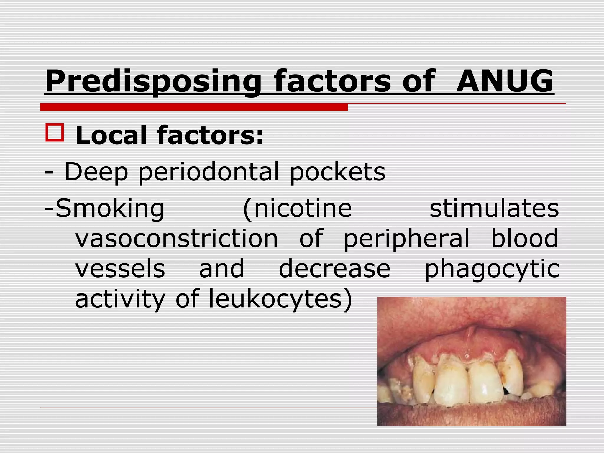 Acute gingival conditions | PPT