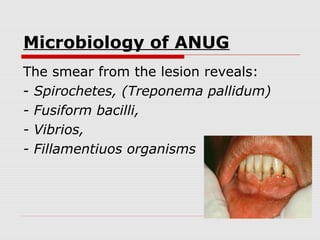 Acute gingival conditions | PPT