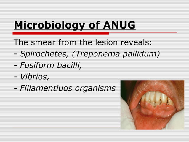 Acute gingival conditions | PPT | Dental Health | Diseases and Conditions