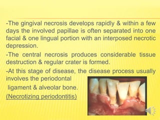Acute gingival conditions.pptx
