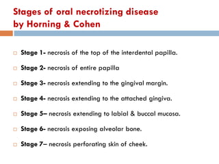 Acute gingival infection of acute infections | PDF