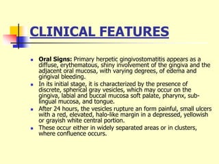 Acute gingival infections | PPTX
