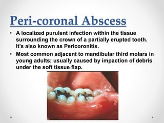 Acute Gingival Infections | PPTX