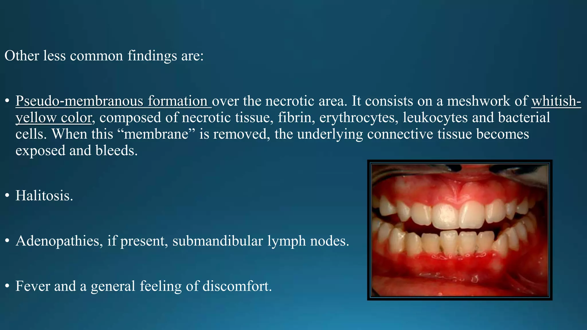 ACUTE GINGIVAL INFECTIONS Based on 2017 Classification.pptx