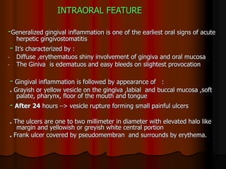 acute gingival lesion.ppt