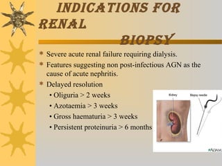 Acute glomerular disease | PPT
