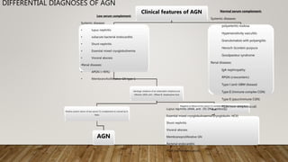 Acute glomerulonephritis by Dr Nongo | PPTX