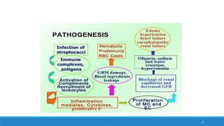 Acute Glomerulonephritis, Bergers disease, Lupus Nephritis, Post strep ...