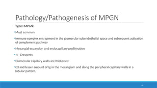 Acute Glomerulonephritis, Bergers disease, Lupus Nephritis, Post strep ...