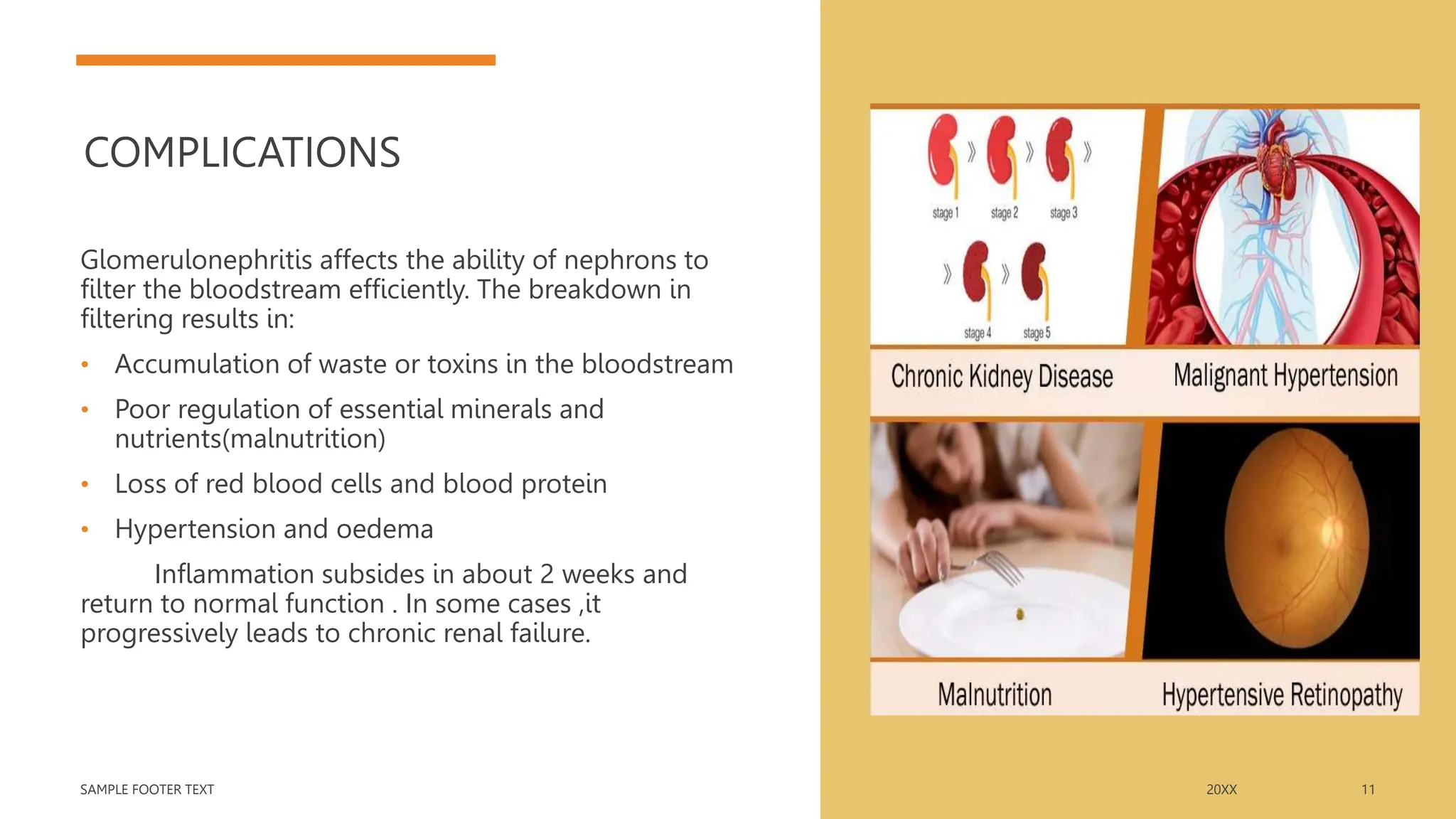 Acute glomerulonephritis and nephrotic syndrome.pptx