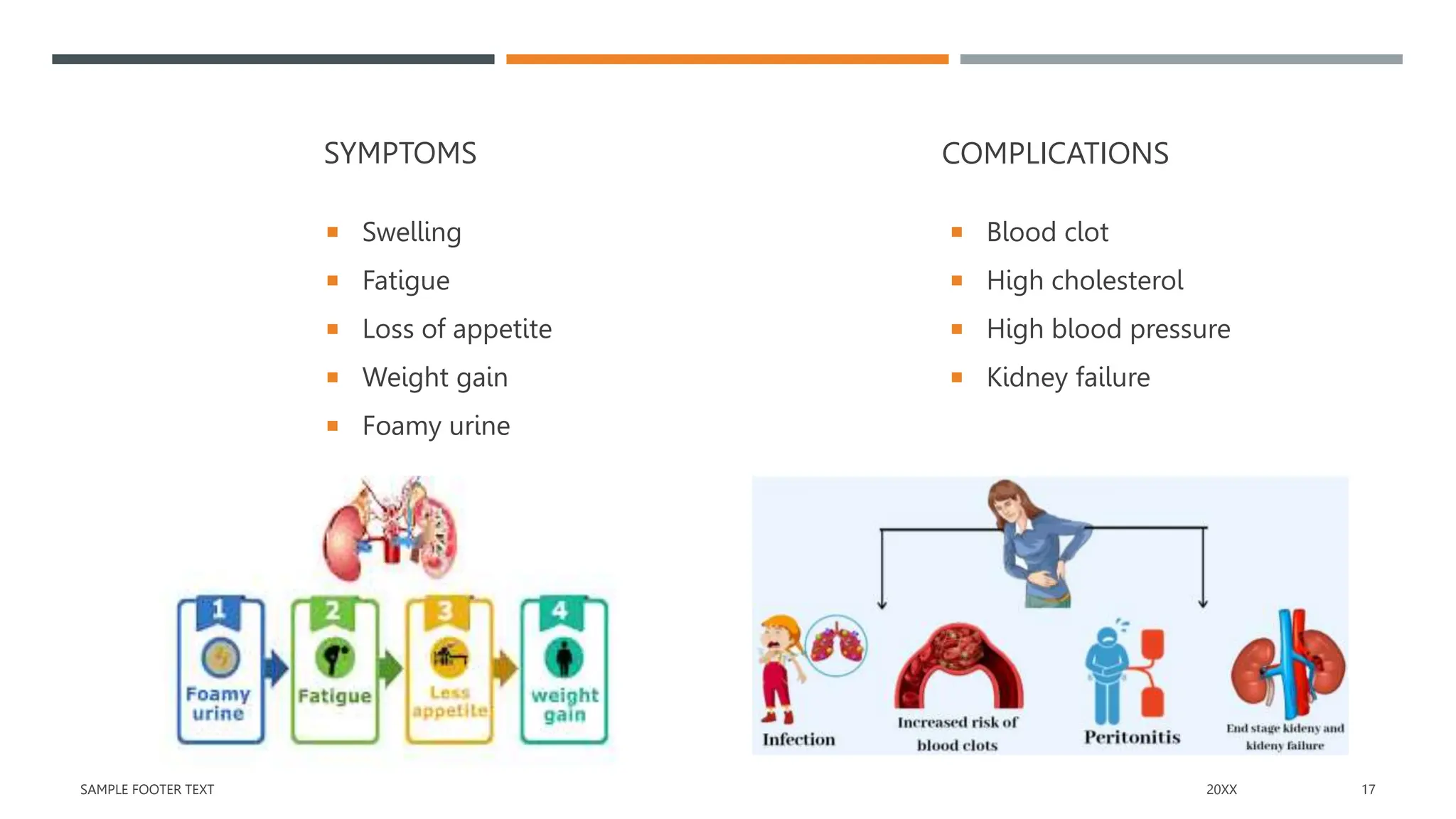Acute glomerulonephritis and nephrotic syndrome.pptx