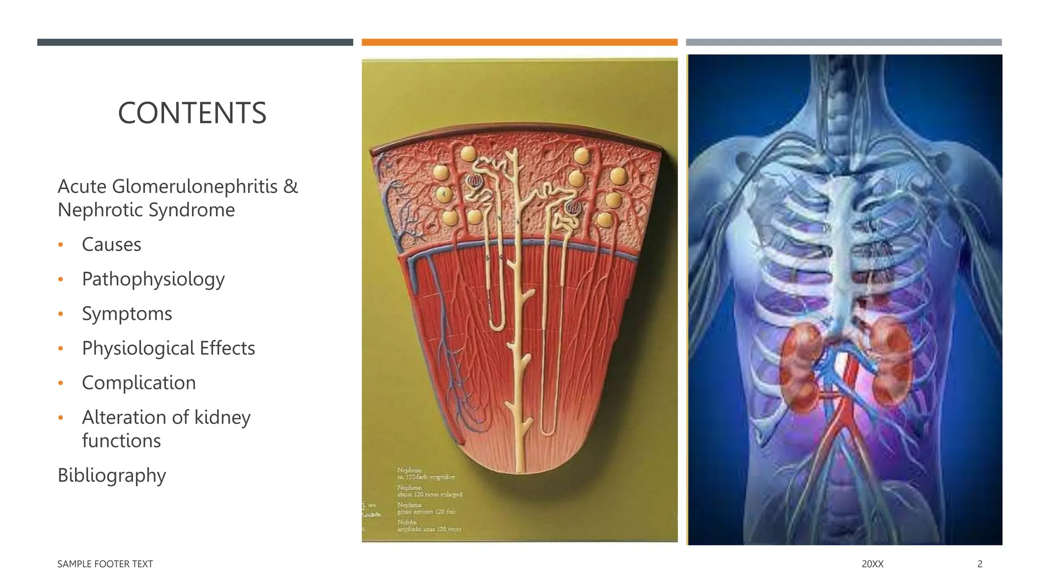 Acute glomerulonephritis and nephrotic syndrome.pptx
