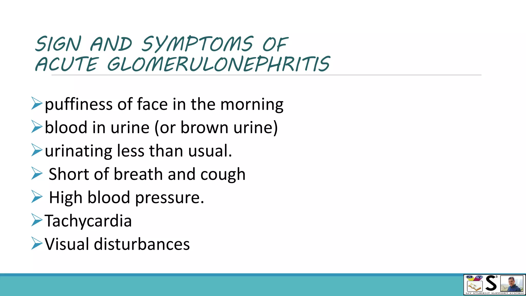 Acute glomerulonephritis in children in english | PPTX