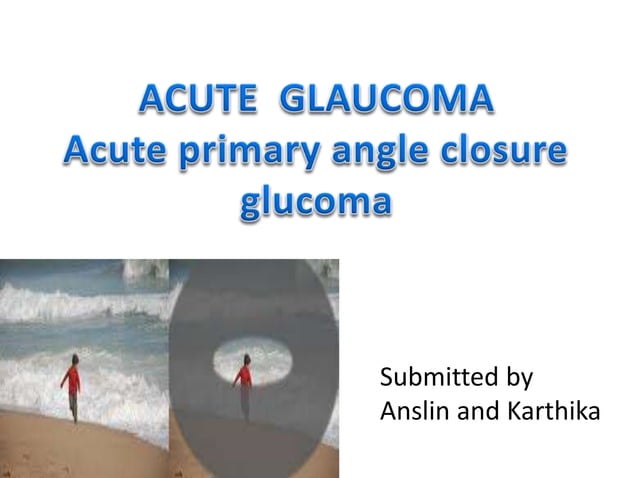 Acute glucoma.pptx | Eye and Vision Conditions | Diseases and Conditions