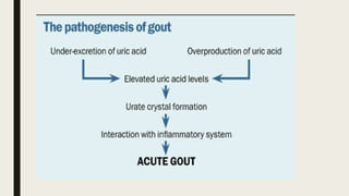 Acute Gout Pathophysiology and Management | PPTX
