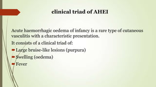 Acute haemorrhagic edema of infacy | PPTX