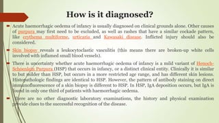 Acute haemorrhagic edema of infacy | PPT
