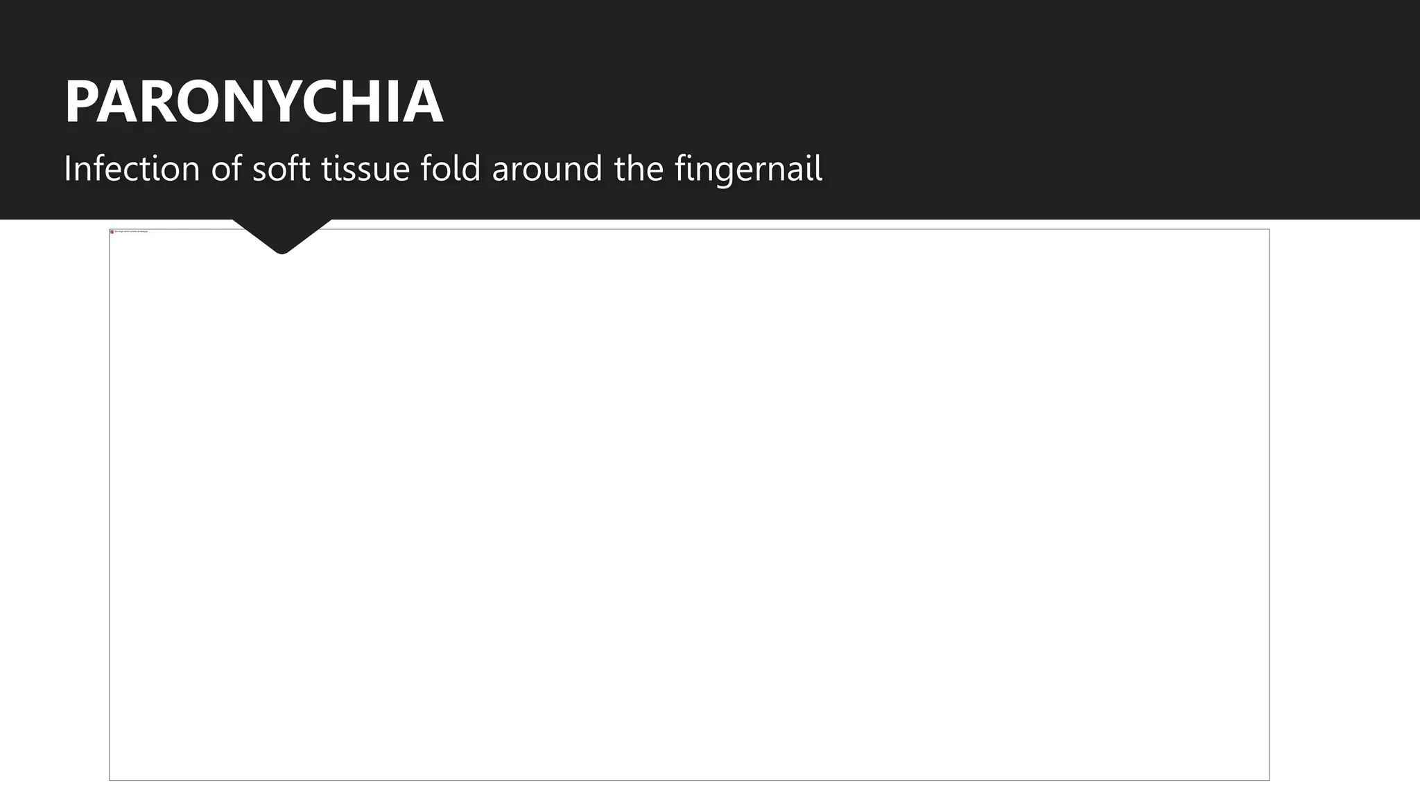 Acute hand infections, IMAGES, SIGNS AND SYMPTOMS, AND MANAGEMENT | PPTX