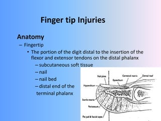 Acute hand injury management | PPTX