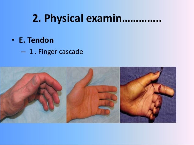 Acute hand injury management