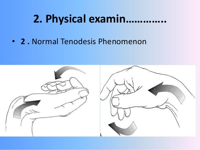 Acute hand injury management