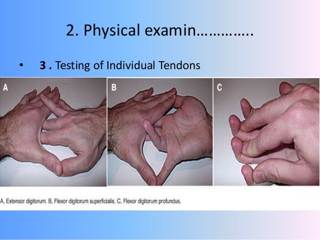 Acute hand injury management