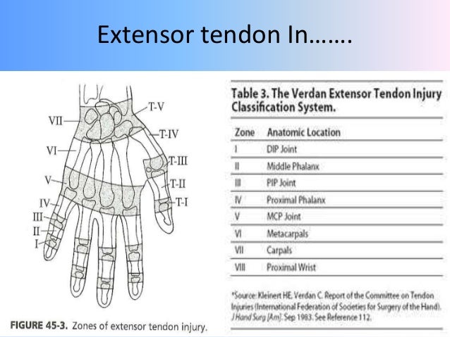 Acute hand injury management