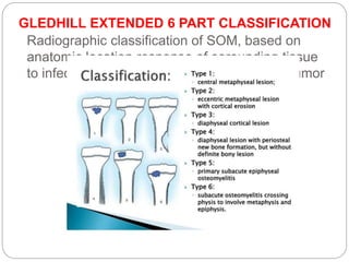 Acute hematogenous osteomyelitis | PPTX
