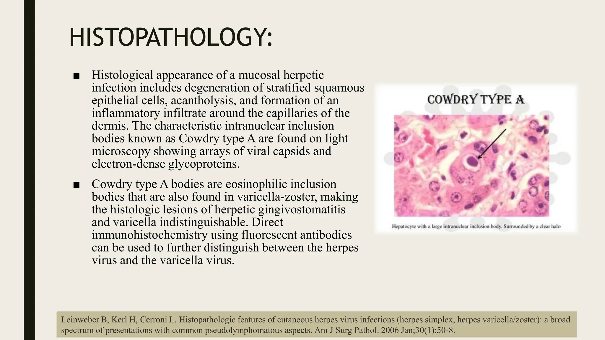 Acute herpetic gingivostomatitis (1).pptx