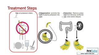 Acute Hyperkalemia Management - Dr. Gawad | PPTX