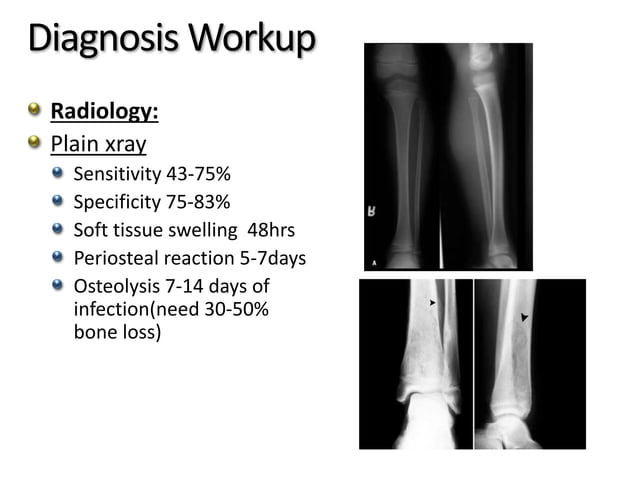 Acute infections of bones and joints | PPTX | Bone and Joint Conditions ...