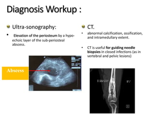Acute infections of bones and joints | PPTX